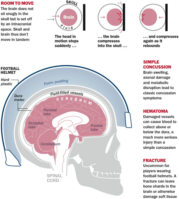 SPACE - THE PREMIER SPORTS INJURY & PHYSIO CLINIC: Concussions in ...