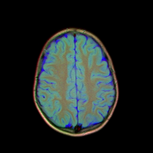 Nevit's blog: Color MRI of the Brain