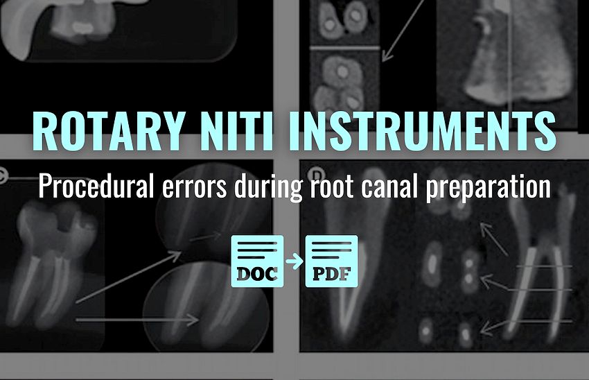 PDF: Procedural errors during root canal preparation using rotary NiTi ...