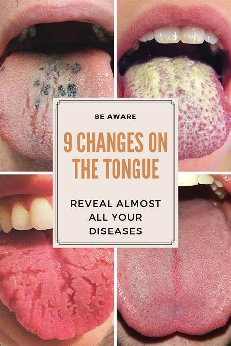 Be Aware Of THIS: These 9 Changes On Your Tongue Reveal Almost All Your ...