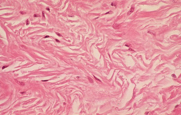 Salisbury's Graduate Histology: Connective Tissue