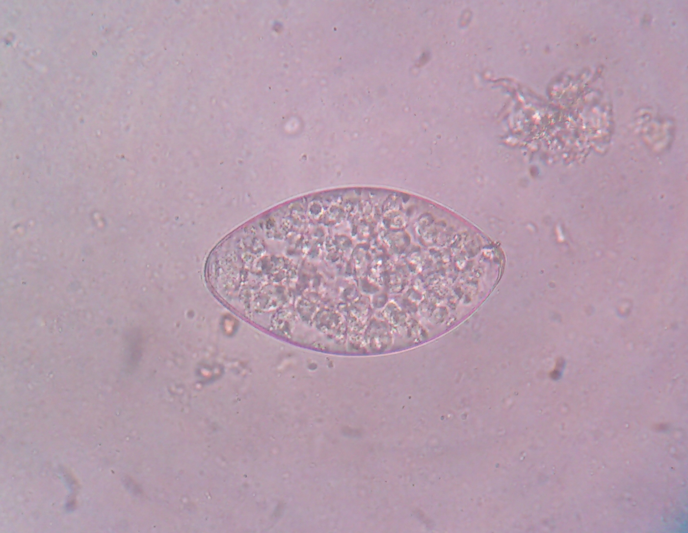 Creepy Dreadful Wonderful Parasites: Case of the Week 227