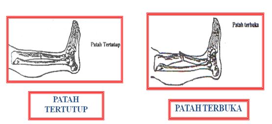 Power Electrical Technology