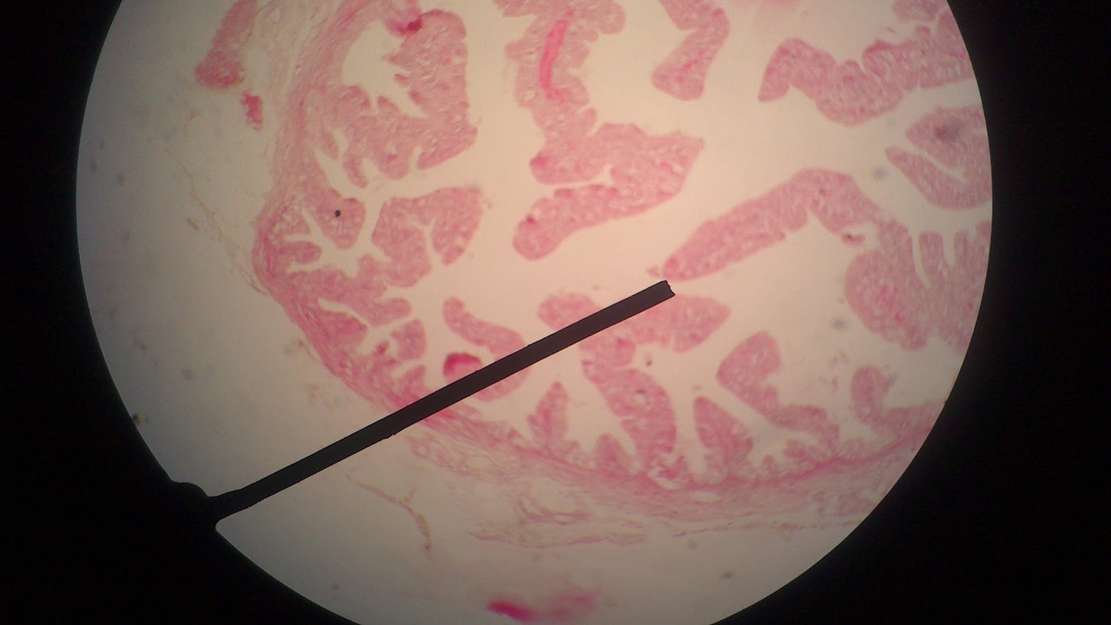 Project Embriologi: Genitalia Feminina