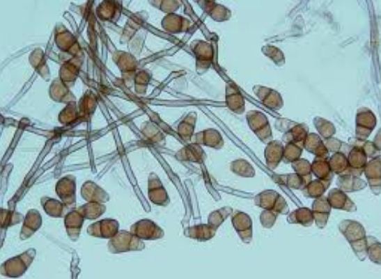 Ciri-Ciri dan Contoh Jamur Deuteromycota