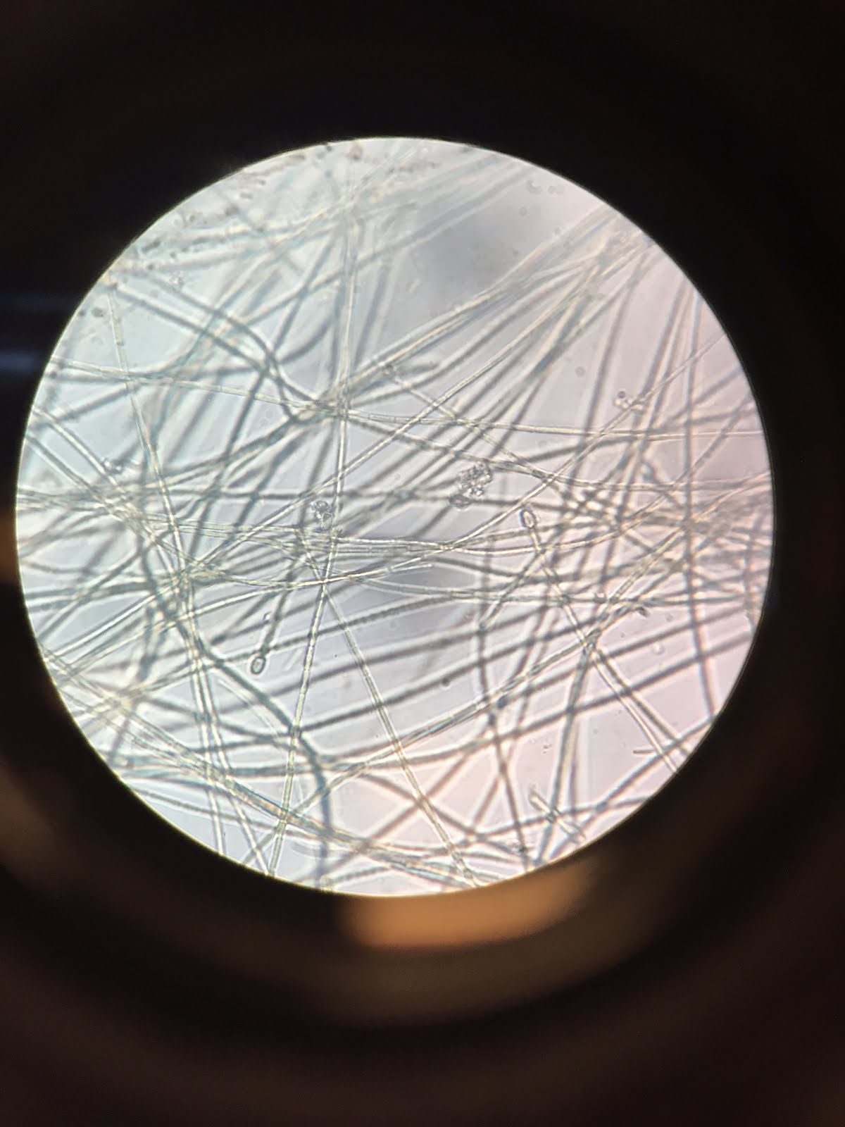 BIOL213 | PLANTS ONE: Chris's Mysterious Bacteria From the Body on a ...