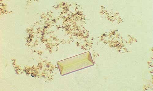Atlas of Crystals found in alkaline urine | Free Medical Atlas