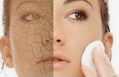 Tips Mengatasi Kulit Kering dan Kusam Secara Alami - Media Remaja
