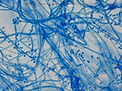 Fun With Microbiology (What's Buggin' You?): Trichophyton rubrum