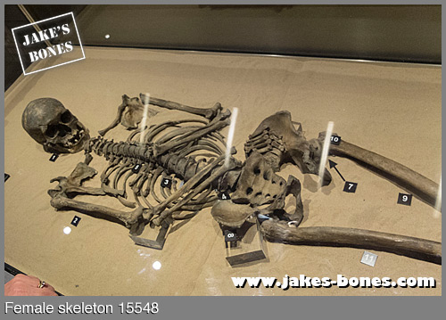 The Viking skeletons at Jorvik : Jake's Bones