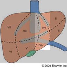 The Pump and the Tubes: Middle Hepatic Artery
