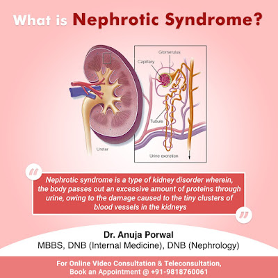 Dr. Anuja Porwal Nephrologist: What is Nephrotic syndrome