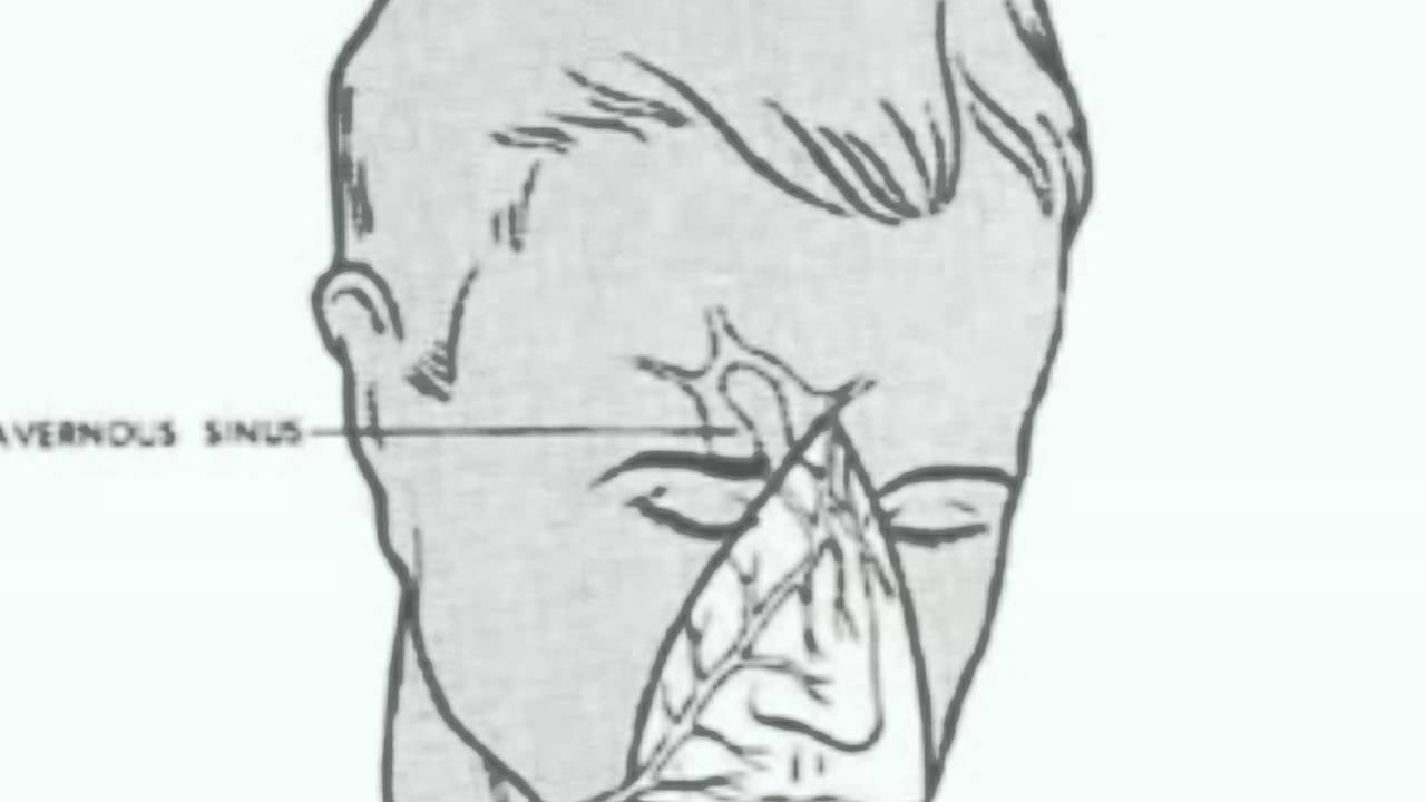 Danger triangle of the face