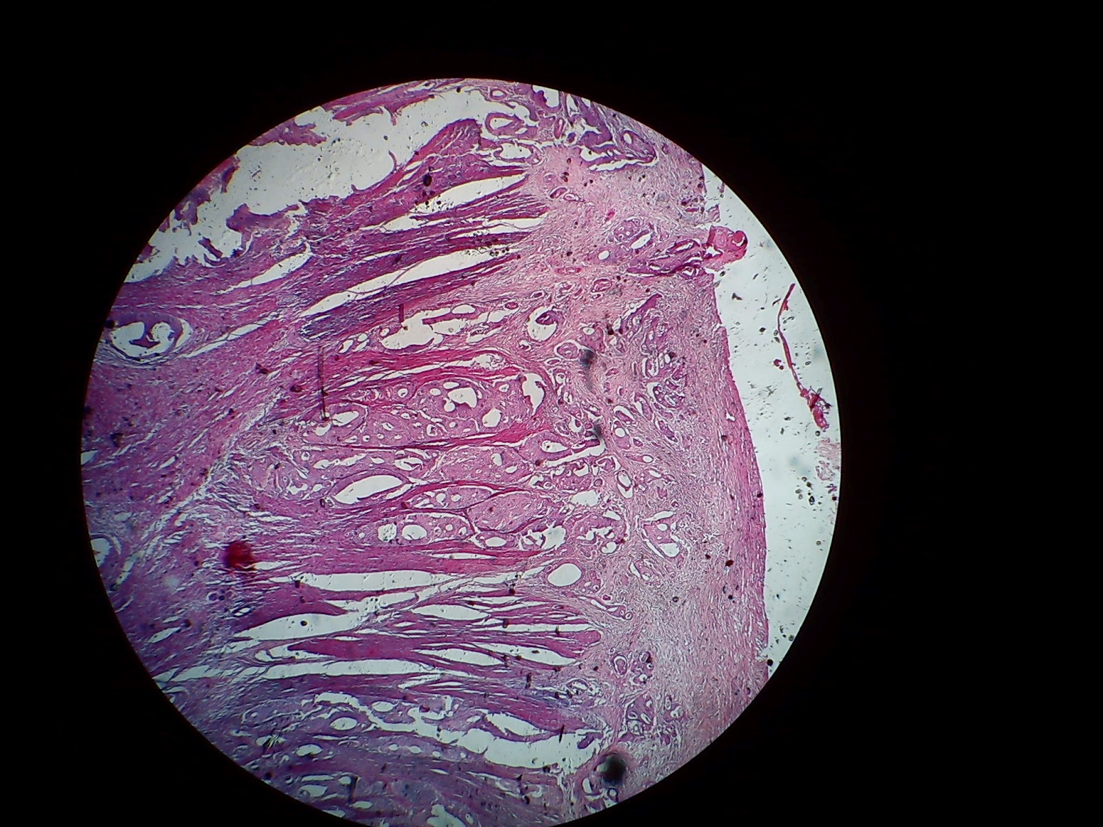 Ca - CaDo (Catatan Calon Dokter): Blok 13 : Praktikum Patologi Anatomi ...