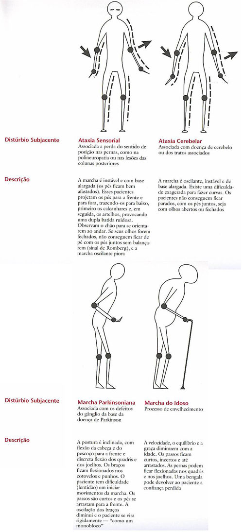 Acervo Fisio: Marchas Patológicas