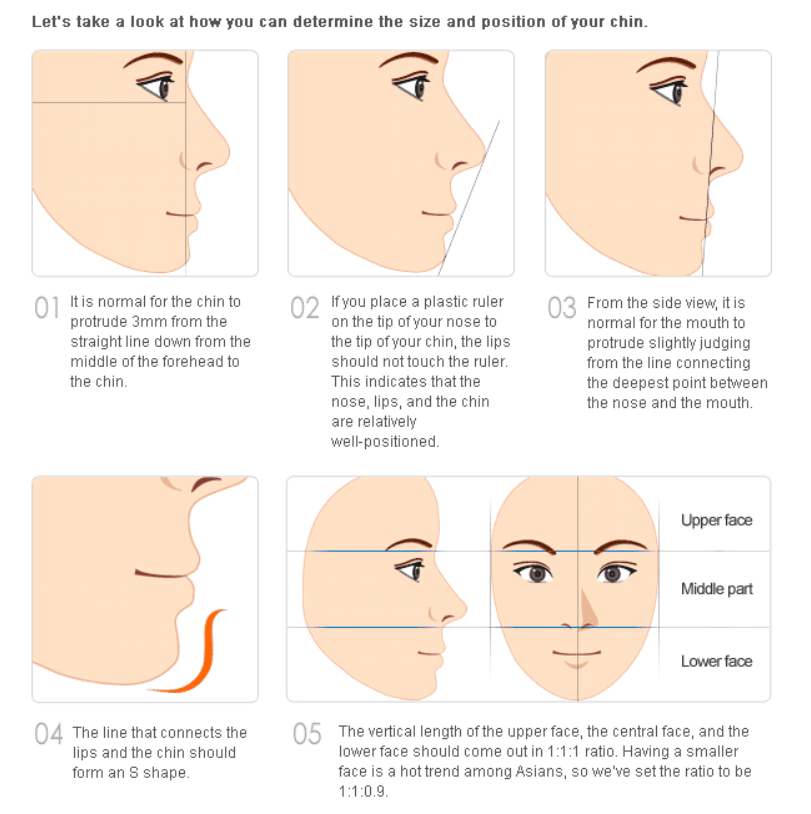 ID Hospital Korea: How to get the perfect V-shaped chin?