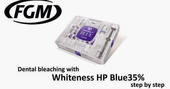 TOOTH BLEACHING: Whiteness HP Blue (Step By Step) - Odonto-Tv