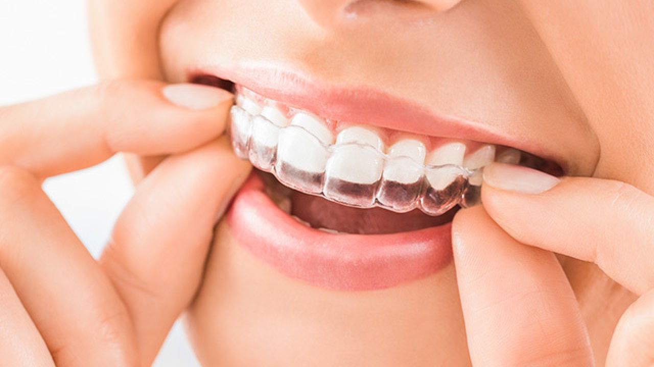 Treatments For Teeth Grinding Night Guards And Beyond treatments-for-teeth-grinding-night-guards-and-beyond