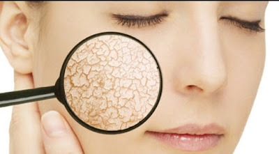 KETAHUI 5 JENIS MASALAH KULIT WAJAH