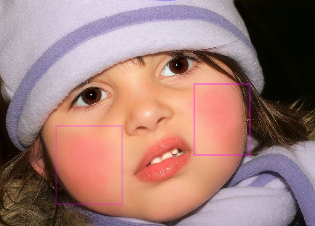 How To Get Gorgeous Pink Cheeks F World