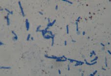 Bacillus Megaterium Acid Fast Stain