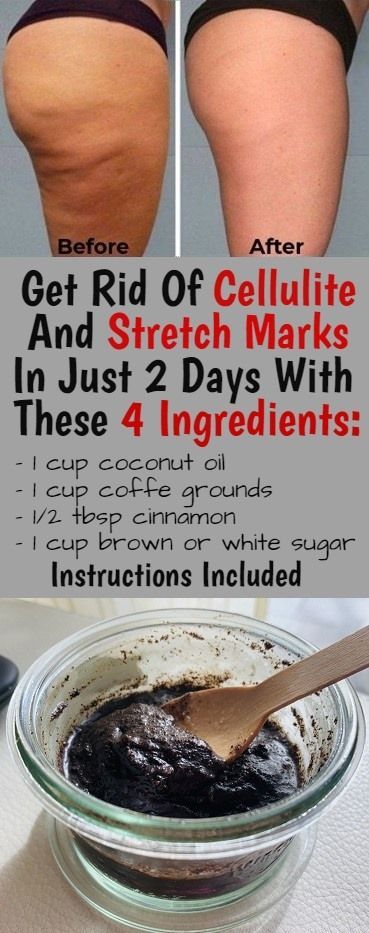 DIY Best Cellulite Scrub That Work Fast In 2 Days! With most Powerful ...