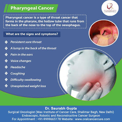 Dr. Saurabh Gupta Oncologist: Signs & Symptoms of Pharyngeal Cancer