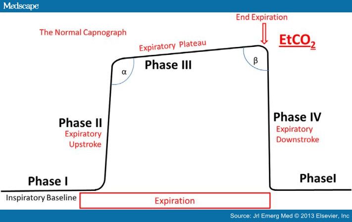EM Didactic: Capnography beyond ROSC