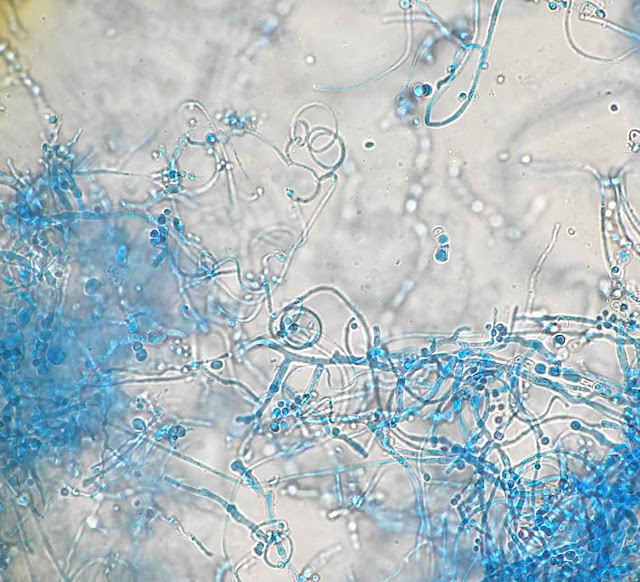 ATLAS MICOLOGIA: TRICHOPHYTON INTERDIGITALE