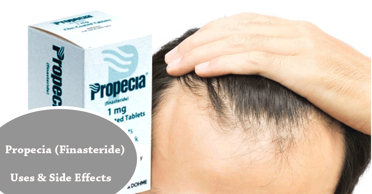 What is Propecia (Finasteride)? Uses and Side effects of Propecia ...
