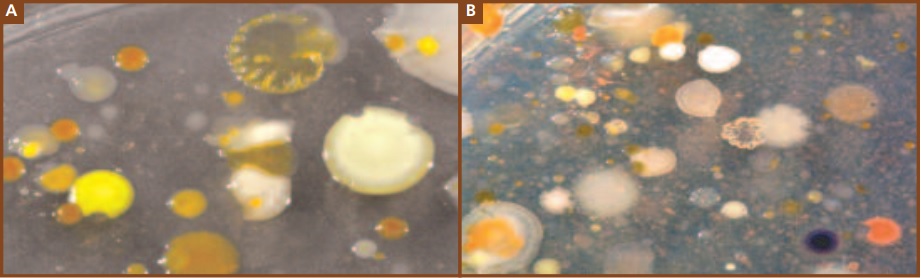 [Microbiology] Atlas of Growth Patterns on Agar | Free Medical Atlas