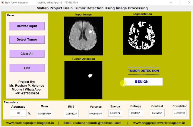 Matlab Code for Brain Tumor Detection and Classification Using Image ... Matlab Code for Brain Tumor Detection and Classification Using Image ...