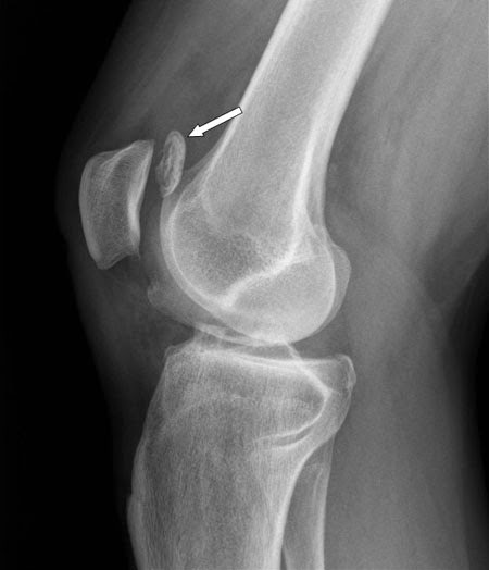 Medische Kennis: Corpus liberum