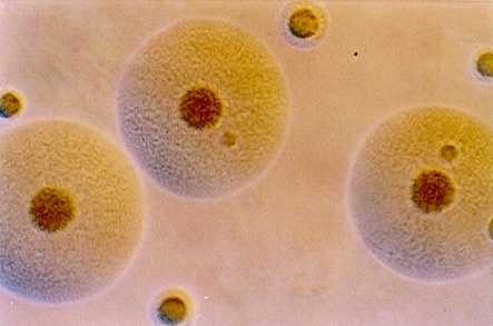 Microbiología : Mollicutes o Tenericutes