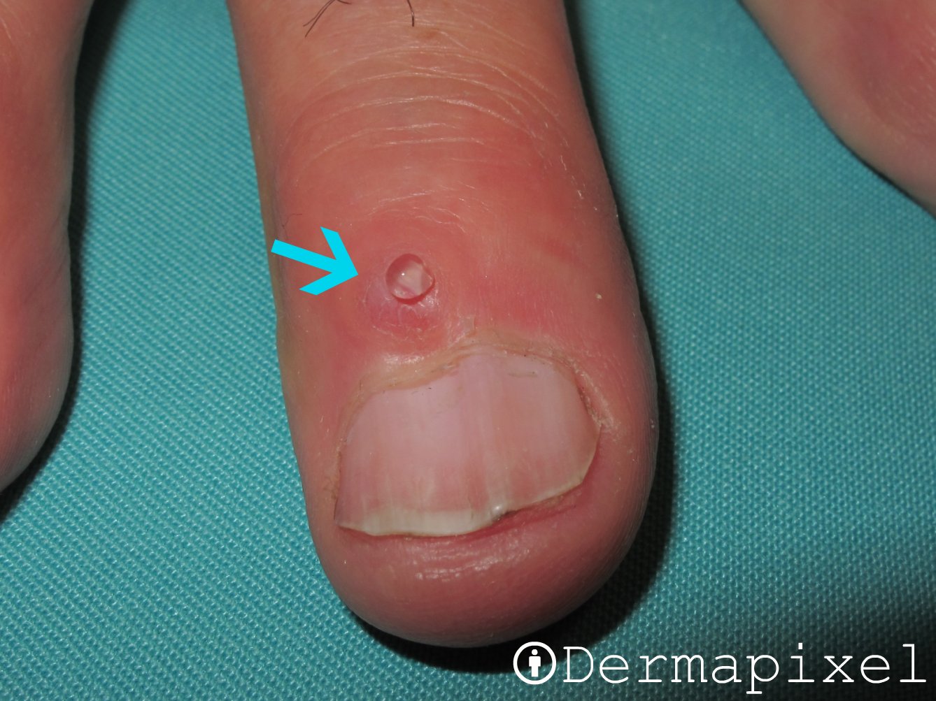 Dermapixel: marzo 2012