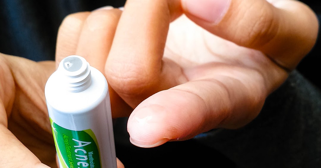 Harga Sabun Acnes Untuk Jerawat - Perumperindo.co.id