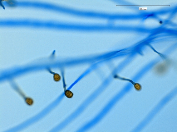 Fun With Microbiology (What's Buggin' You?): Stemphylium species