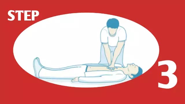 সিপিআর কাকে বলে - সিপিআর দেওয়ার নিয়ম