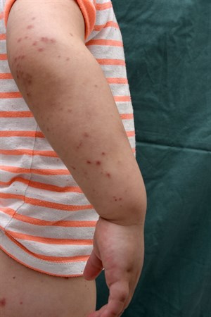 PEDIATRICS MCQS, TOACS, PEARLS & UPDATES FOR MRCPCH/FCPS/MCPS EXAMS ...