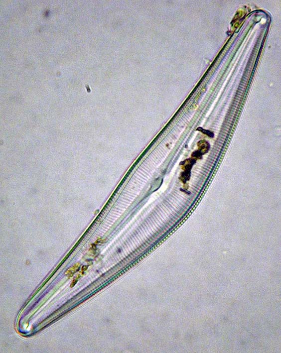 Beyond the Human Eye: Life in a Few Drops of Water: Diatoms