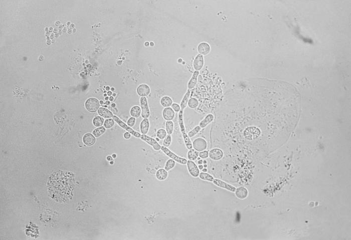 Erboristeria e dintorni: VAGINITI RICORRENTI DA CANDIDA
