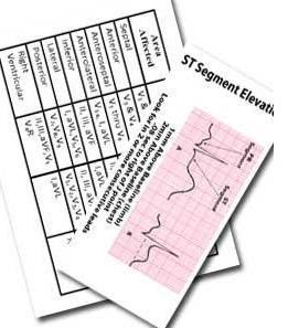 12 Lead EKG: 12 lead EKG Pocket Card