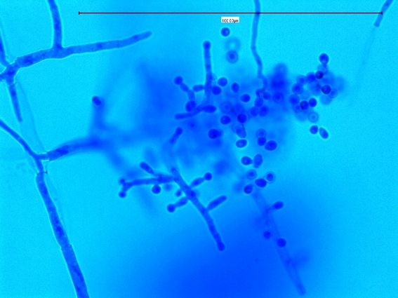 Fun With Microbiology (What's Buggin' You?): Trichophyton ...