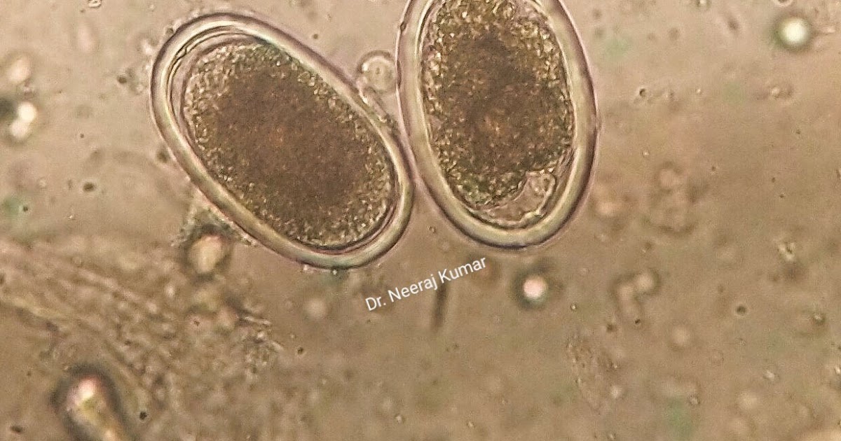 VETERINARY PARASITOLOGY: Heterakis gallinarum