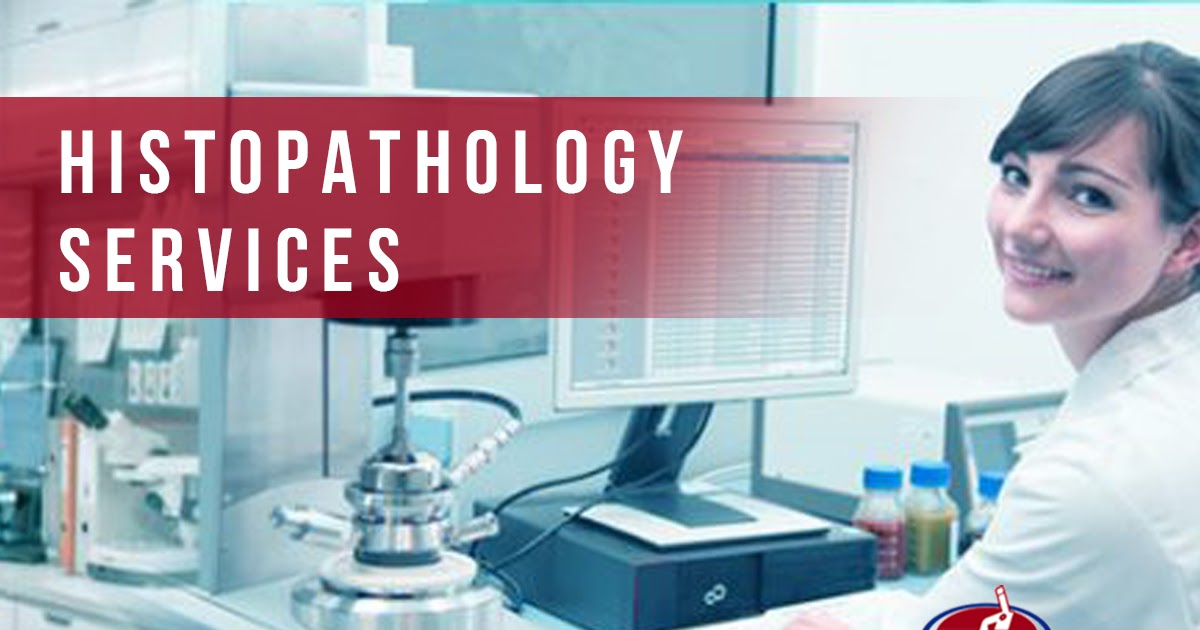 All about Histopathology Laboratory Test For the Diagnosis of Diseases