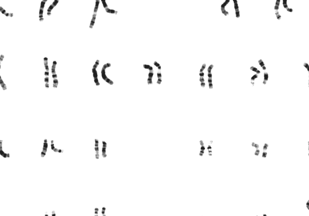Karyotype - Human Karyotyping
