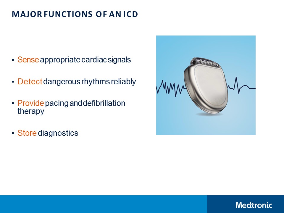 CVT Mohd Farid: Concept Of ICD Technology-Sensing & Detection-Medtronic ...