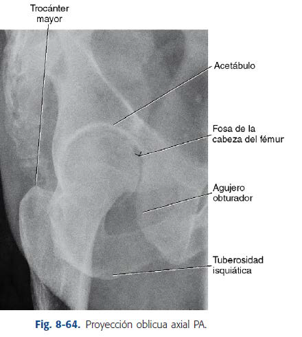 PRODUCCION Y TRATAMIENTO DE IMAGENES DIAGNOSTICAS: CAPITULO FEMUR Y ...