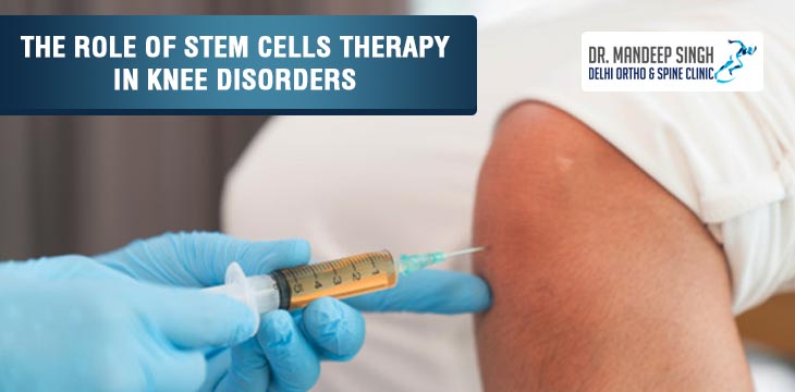 The Role Of Stem Cells Therapy In Knee Disorders