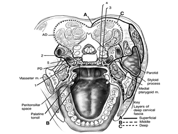 ENT for you and me: Apa sih Amandel?